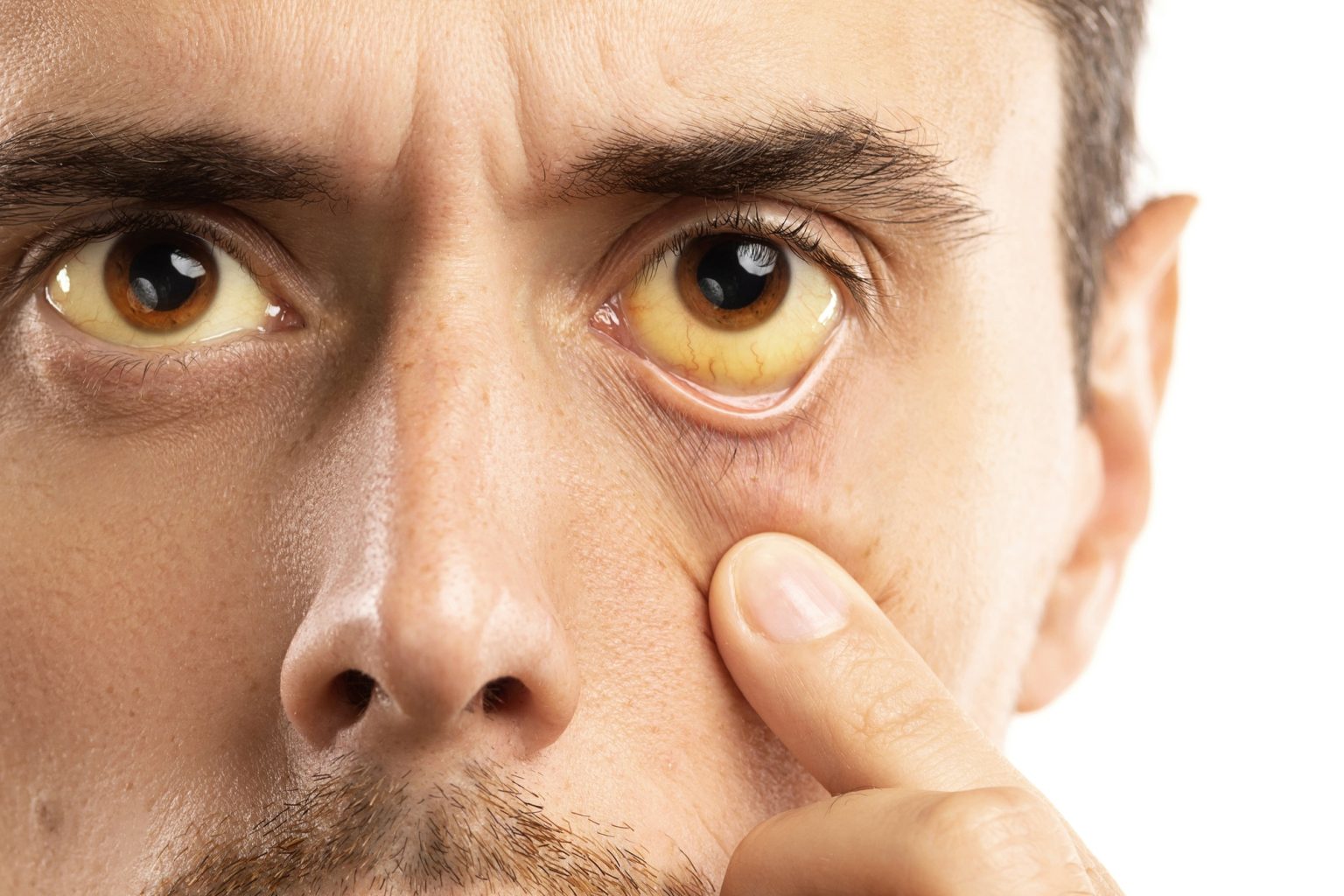 6 Commons Symptoms of Liver Health Problems - GoWellness
